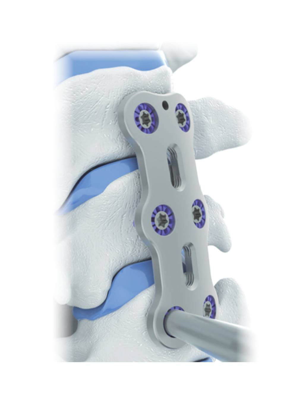 HWS-Platten | Hochwimmer Klinikprodukte - Medizinische und chirurgische ...