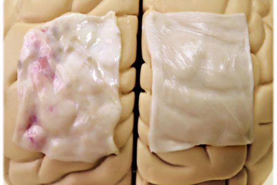 Durapatch | Hochwimmer Klinikprodukte - Medizinische und chirurgische ...